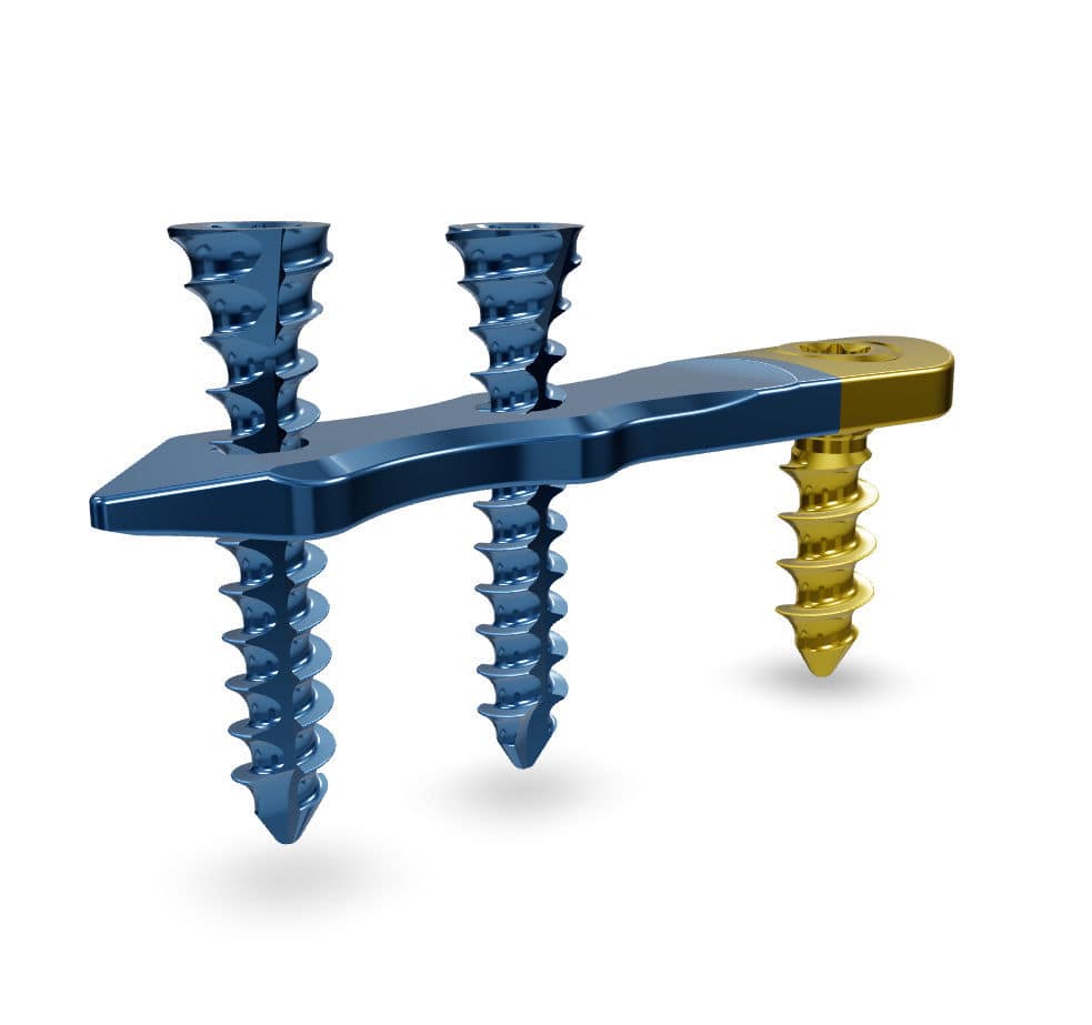 Hallux valgus compression plate - 26.26.35.27 series - Astrolabe ...