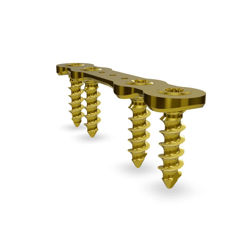 Hallux valgus arthrodesis plate - 26.26.01.35041 - Astrolabe - plantar ...