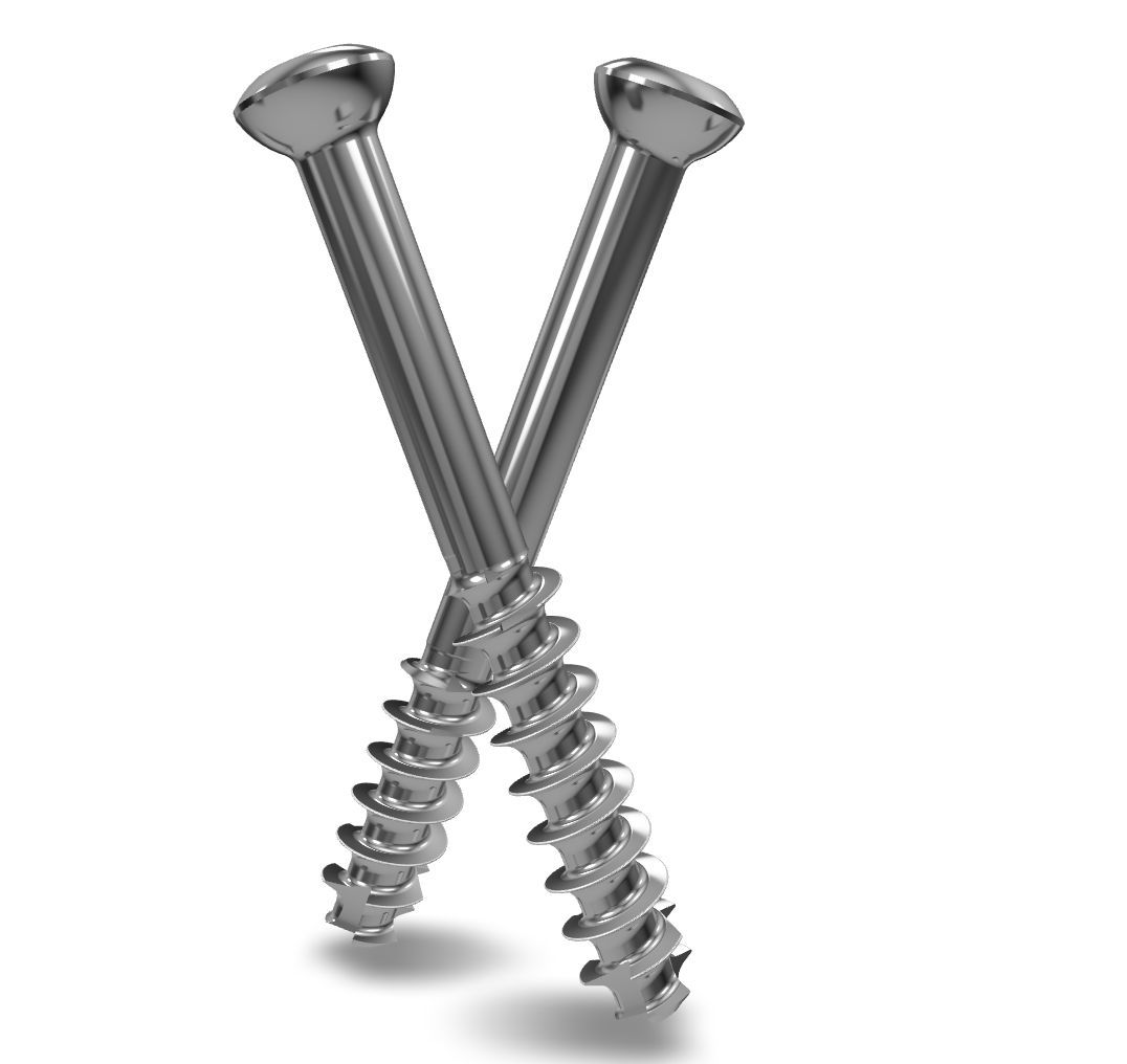 Hallux valgus compression bone screw - 15.40.01.400 series - Astrolabe ...