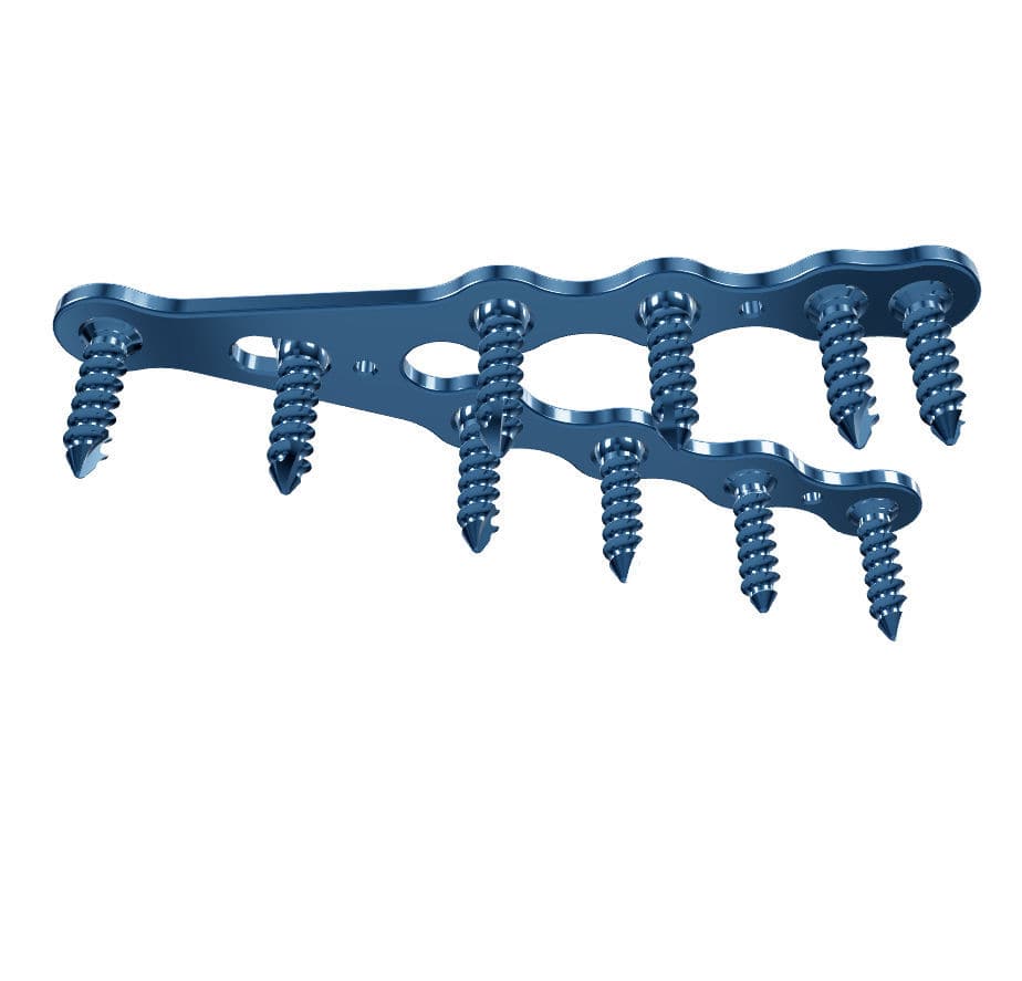 Radius compression plate - 26.24 series - Astrolabe - distal / locking ...