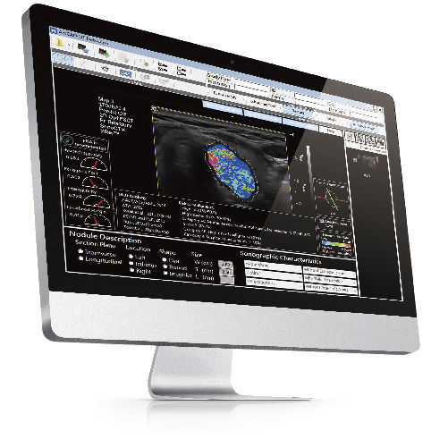 Ultrasound imaging software - AmCAD-UT® - AmCad BioMed - image analysis ...