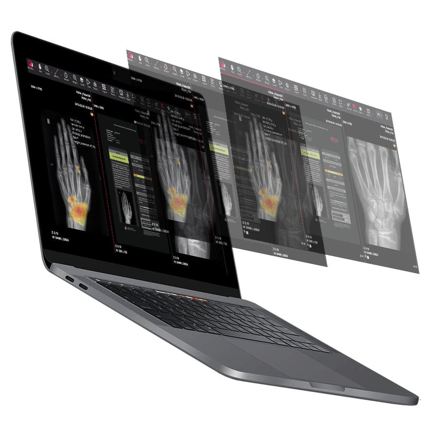 Image analysis software - PANDA - Imagebiopsy Lab - reporting ...