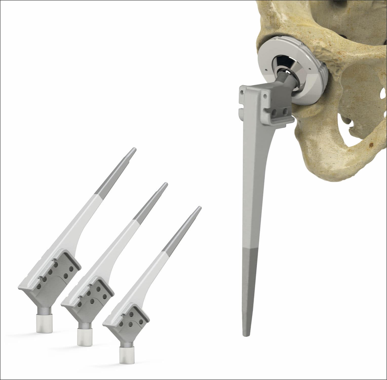 Primary hip prosthesis - 7033 series - Zimed Medical - cementless