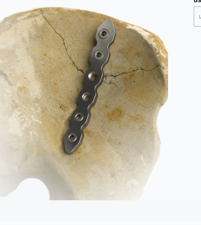 Small bone fragment compression plate - 1422 series - Zimed Medical ...