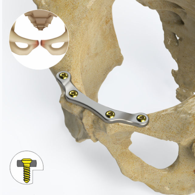 Pelvis compression plate - 9742 series - Zimed Medical - locking / metallic