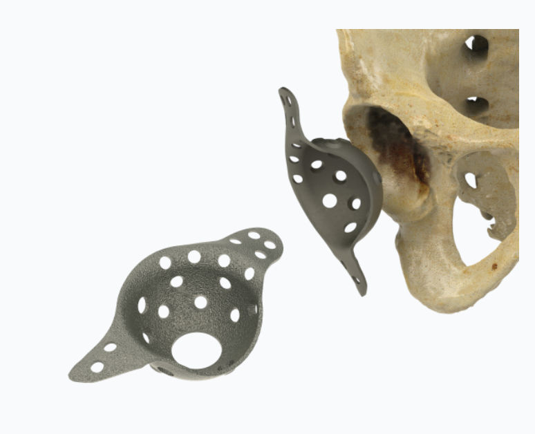 Acetabular reinforcement - R.7582-00 series - Zimed Medical