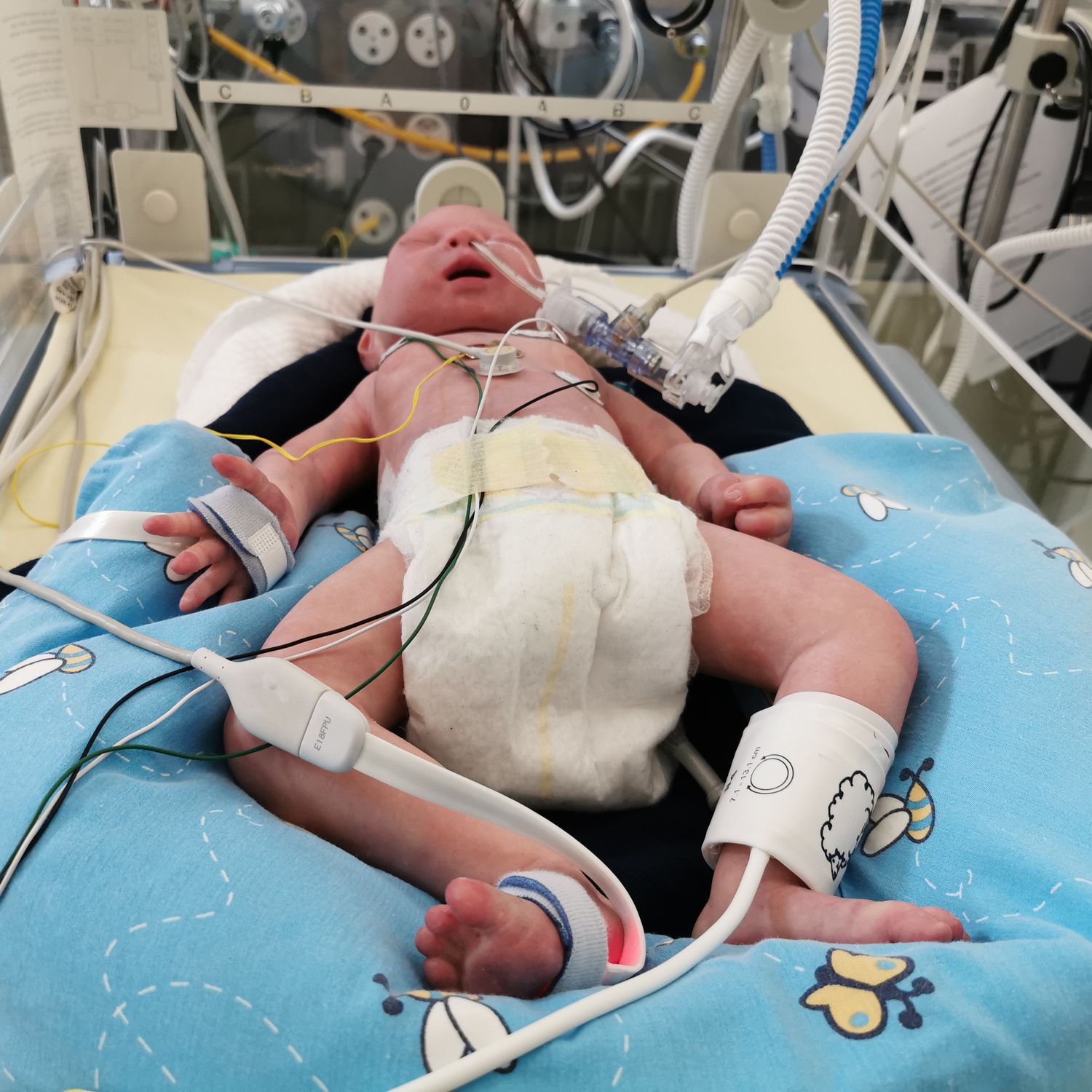 Baby lung simulator - LuSi - neosim AG - emergency care / training ...
