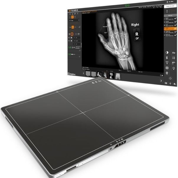 Multipurpose radiography flat panel detector - TeseoX - Digitec ...