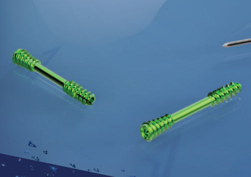 Ankle arthrodesis screw - AGOMED Medizin-Technik - headless ...