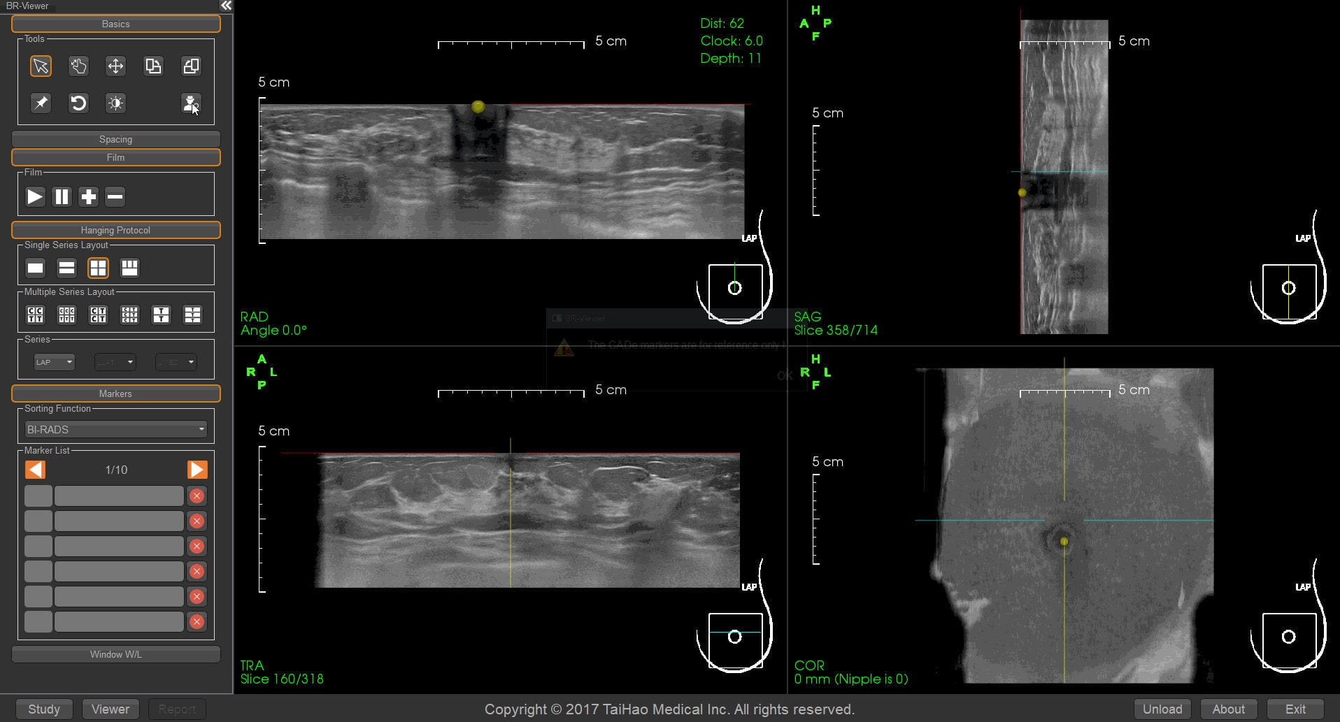 Reporting software - BR-Viewer™ - TaiHao Medical - viewer / diagnostic ...