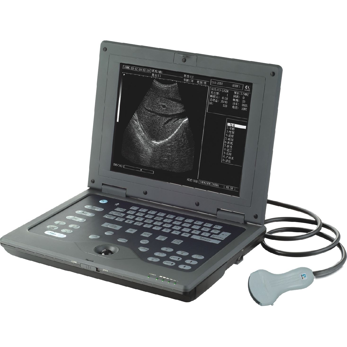 Portable ultrasound system - XU-201H - Xindray Medical - for ...