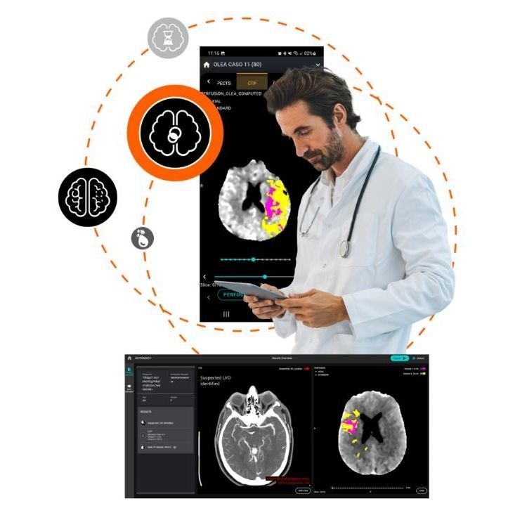 Treatment software - Olea Medical - medical / emergency