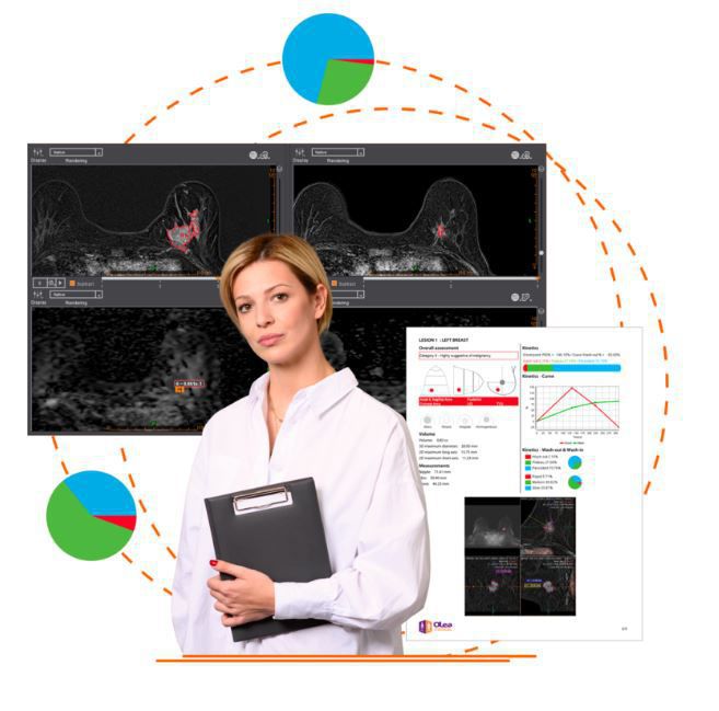 Image analysis software - SPHERE® 3.0 - Olea Medical - reporting ...