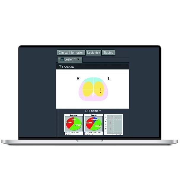 MRI software - SPHERE® 3.0 - Olea Medical - measurement / image ...