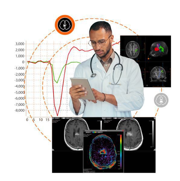 MRI software - SPHERE® 3.0 - Olea Medical - data analysis / image ...