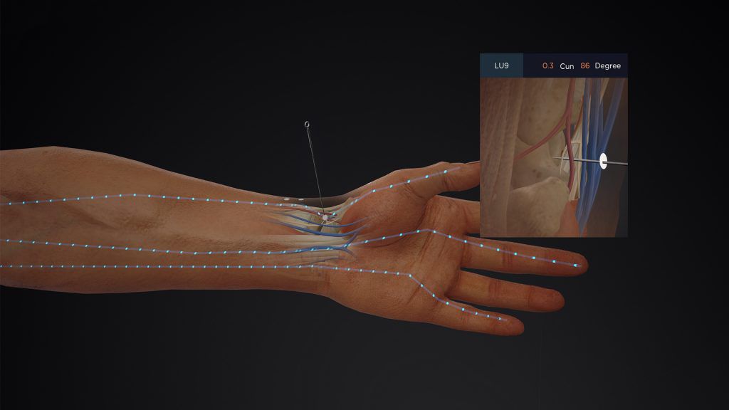 Anatomy software - AcuMap - Medical Augmented Intelligence (MAI) - for ...