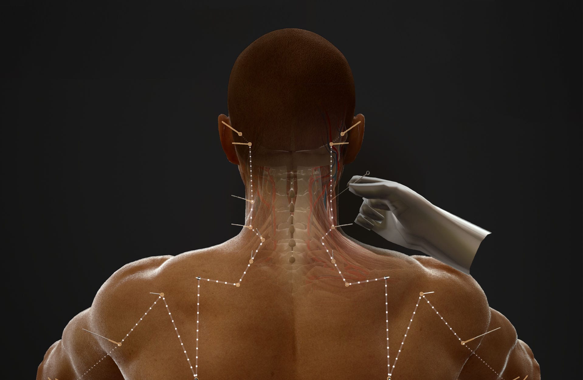 Visualization software - AcuMap - Medical Augmented Intelligence (MAI ...