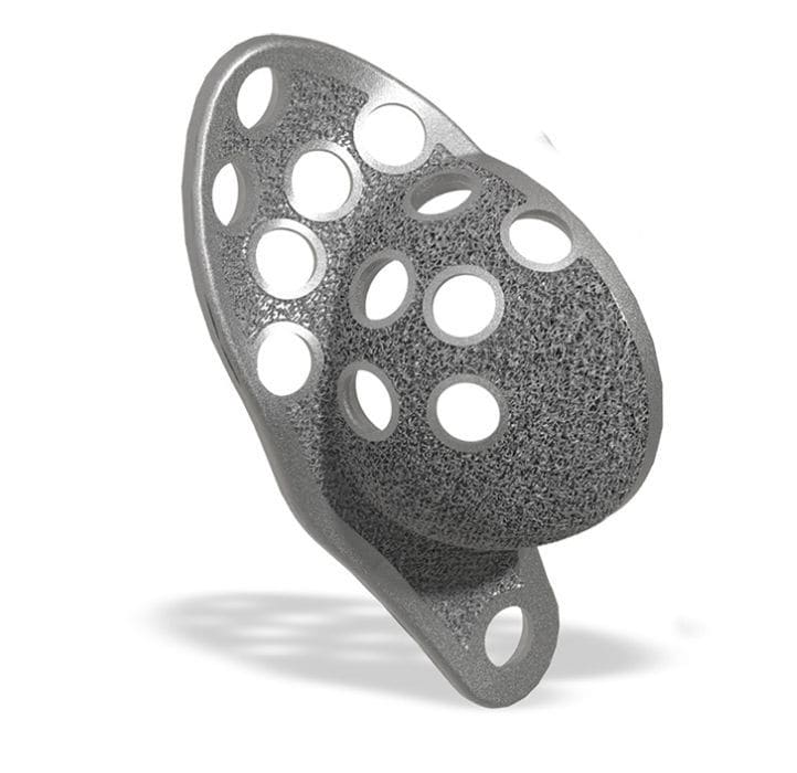 Acetabular reinforcement - Permedica Orthopaedics