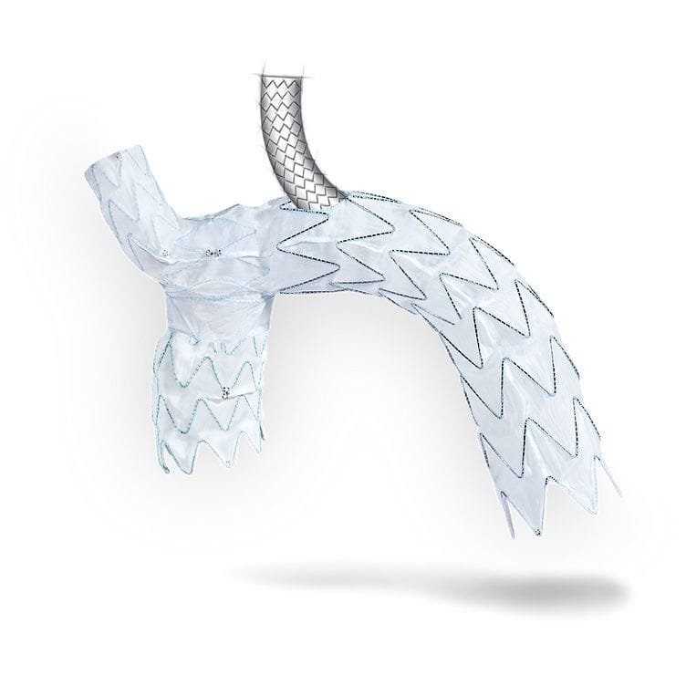 Aortic arch stent graft - NEXUS DUO™ - Endospan - nitinol / polyethylene