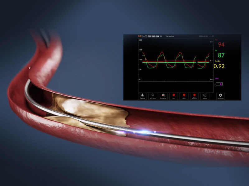 Pressure sensor - Shanghai TOW Intelligent Technology - for animal ...