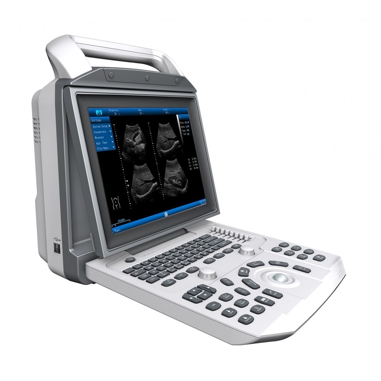 Portable ultrasound system - SLE 901 - Medelcom International - for ...