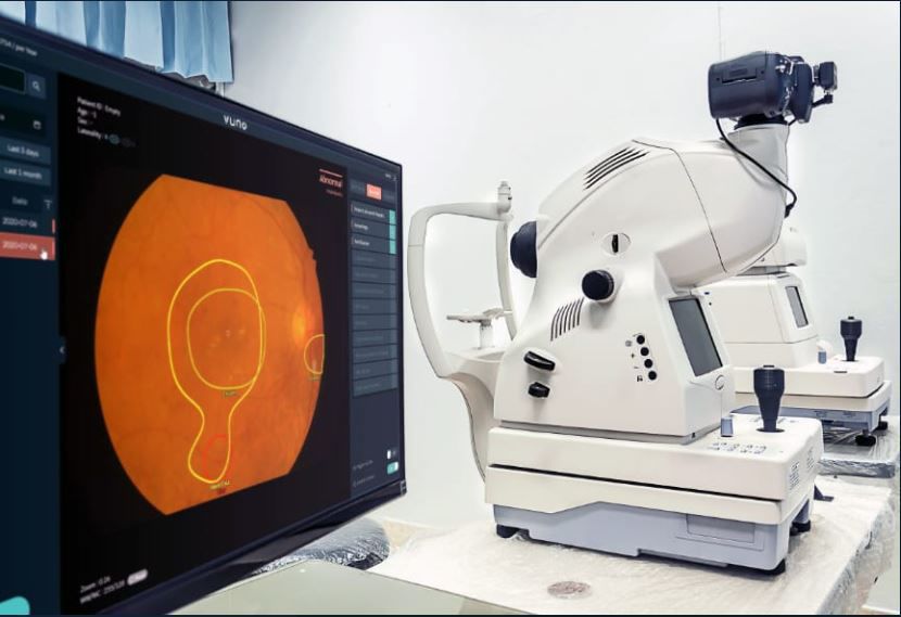 Diagnostic software - VUNO Med®-Fundus AI™ - VUNO - screening / for ...