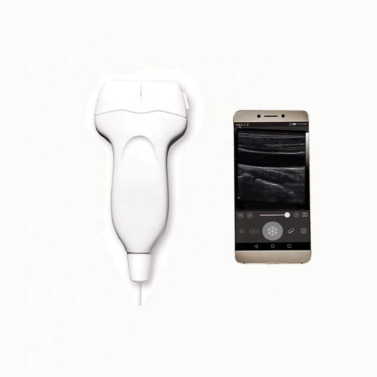 Hand-held ultrasound system - HS-UP20L - Healson Technology - for ...