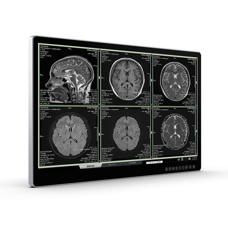 Medical imaging display - UHD Surgical Monitor - Vecoton Technology ...