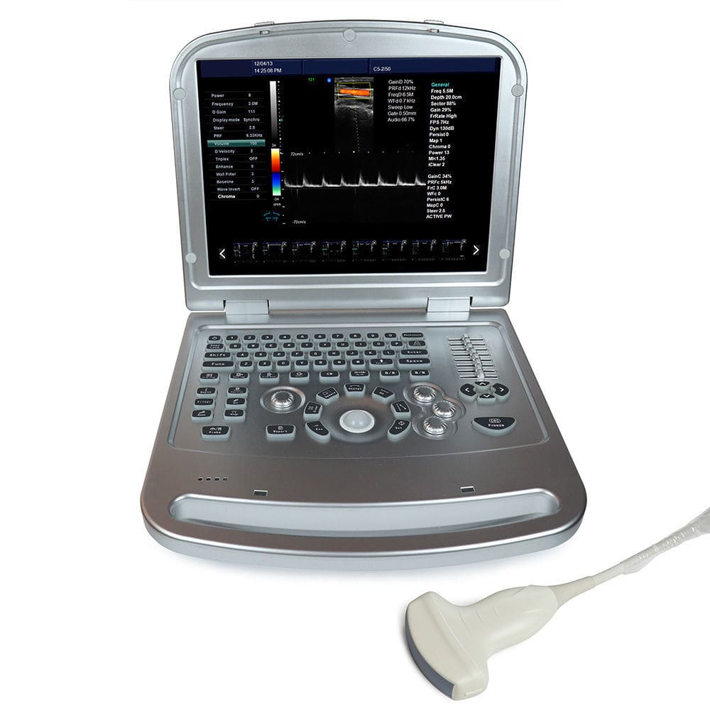 Portable ultrasound system - MDK-870 - Mianyang United Ultrasound ...
