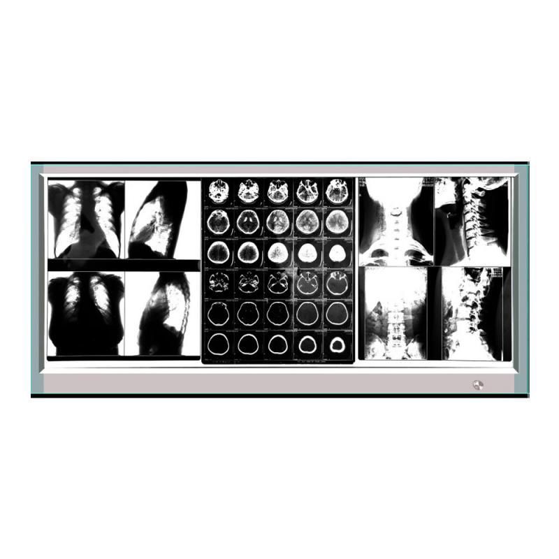 3-screen X-ray film viewer - GP1003A - Bellamoon Medical - LED