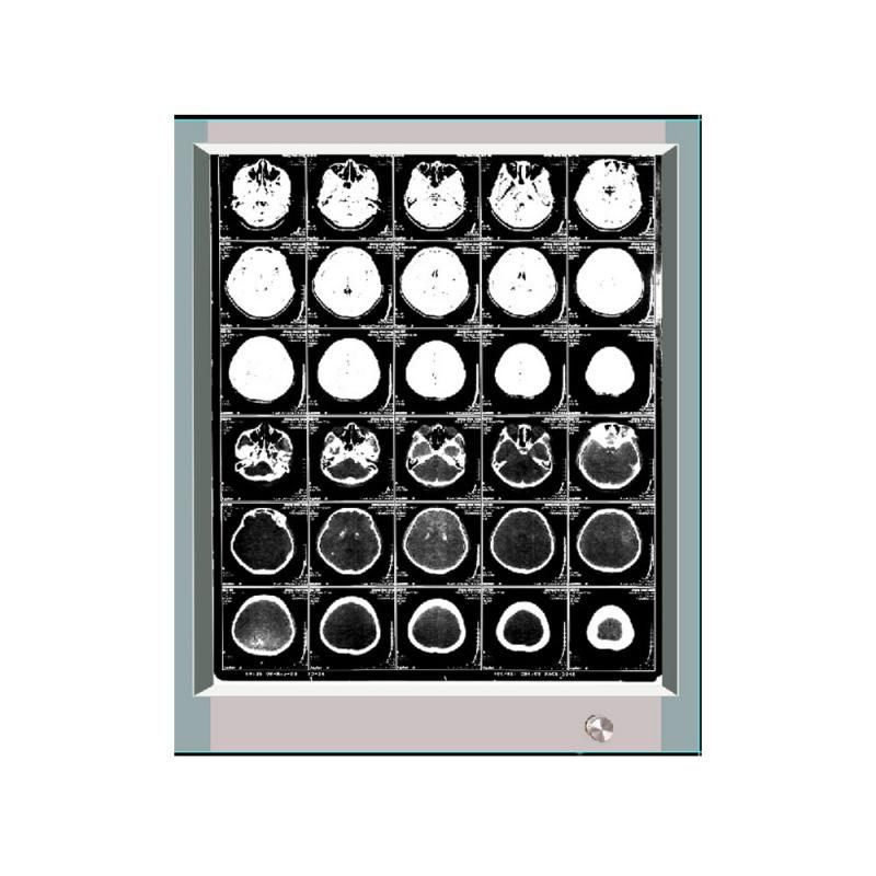 1-screen X-ray film viewer - GP1001A - Bellamoon Medical - LED