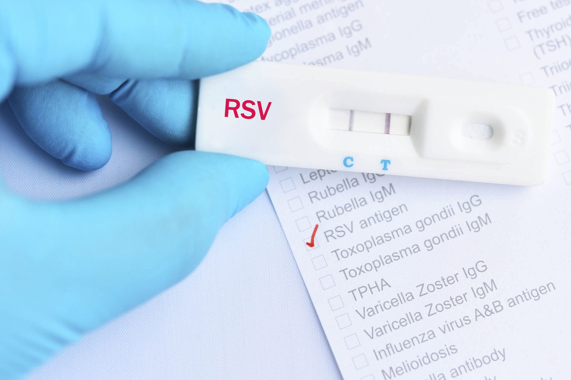 Rapid Infectious Disease Test RSV BIOMED Labordiagnostik GmbH For Rapid Infectious Disease Test RSV BIOMED Labordiagnostik GmbH For