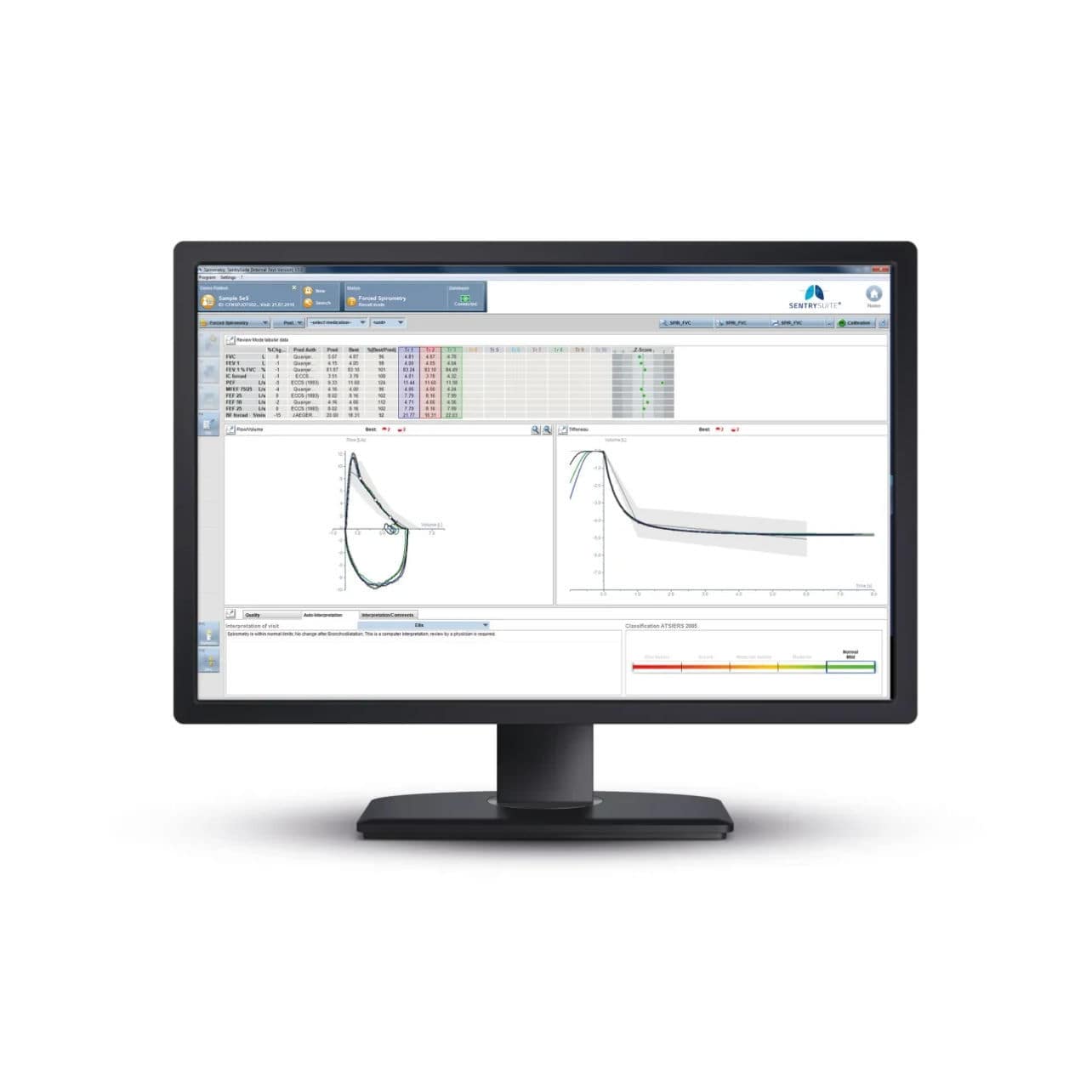 Management software - SentrySuite™ - JAEGER MEDICAL - analysis ...