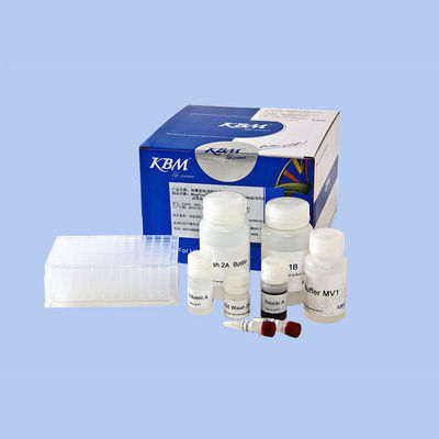 DNA extraction reagent kit - HangZhou KBM Life Sciences Co., Ltd ...