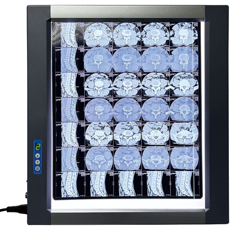 LED X-ray film viewer - MST-4000I - Shantou Easywell Electronic Technologies - digital / 1-screen