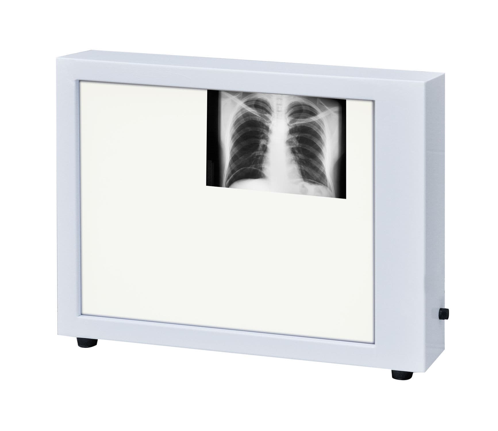 1-screen X-ray film viewer - N-2 - Zapovit - LED
