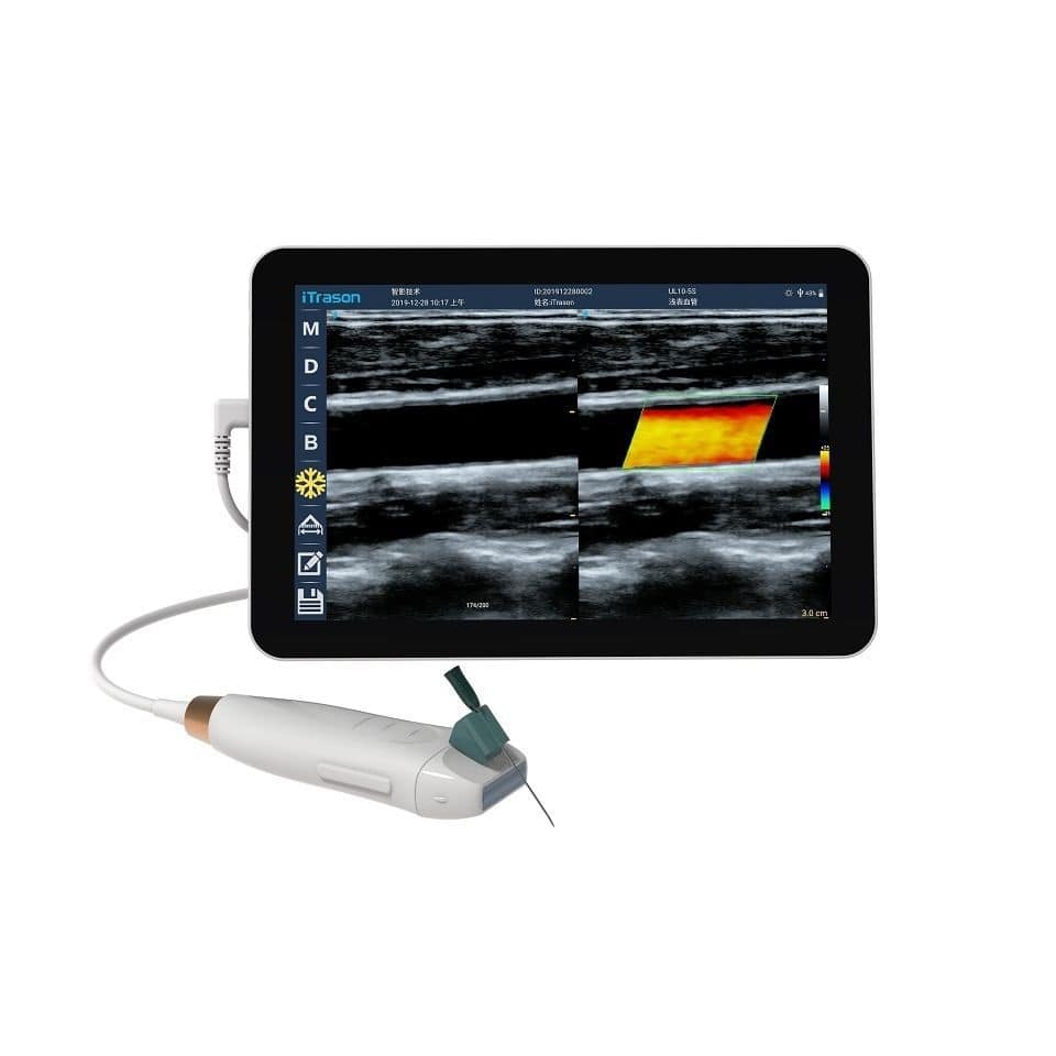Hand-held ultrasound system - UL10-5E - Beijing iTrason Technologies ...