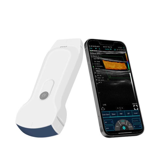 Hand-held ultrasound system - C10RL - Beijing iTrason Technologies ...