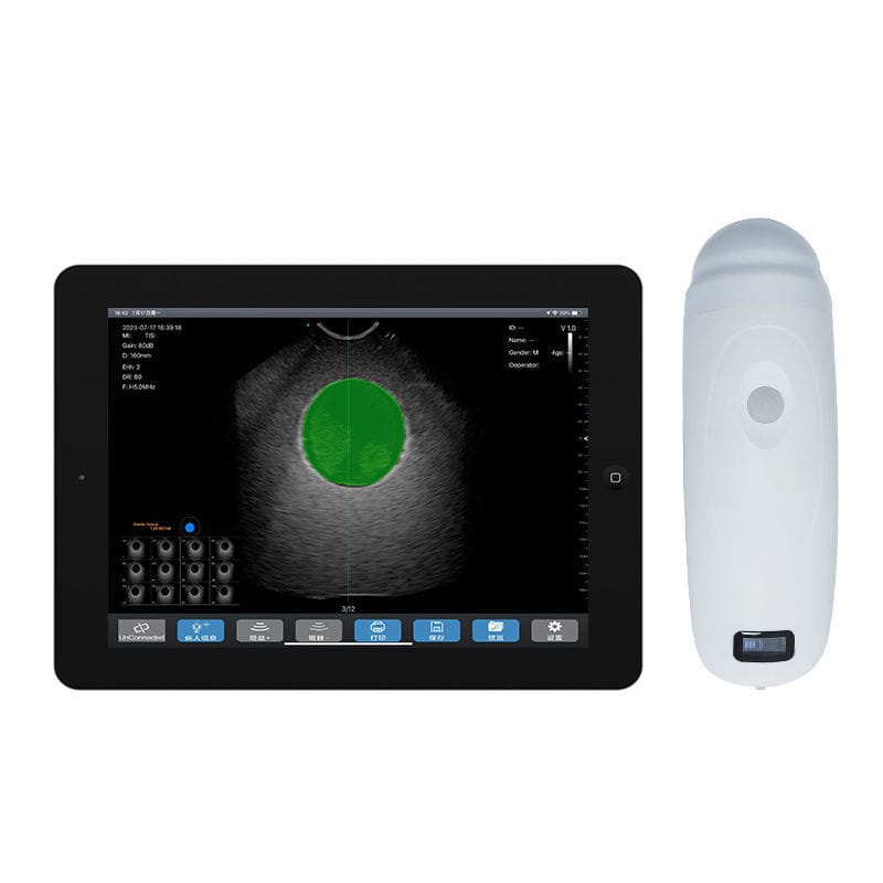 Hand-held bladder scanner - BS2 - Beijing iTrason Technologies