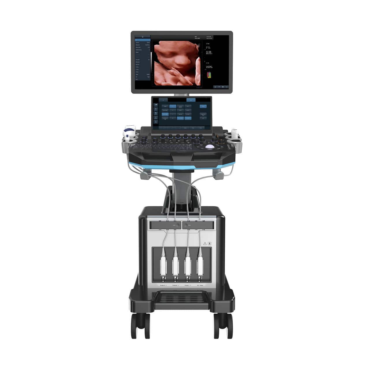 On-platform ultrasound system - GT50 - Beijing iTrason Technologies ...
