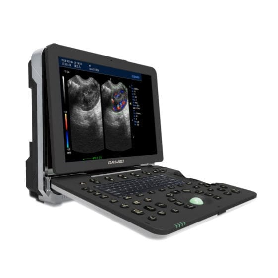 Portable veterinary ultrasound system - P6-VET - Dawei Medical ...