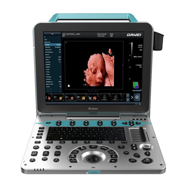 3D/4D ultrasound system - DW-P50 - Dawei Medical - portable / for ...