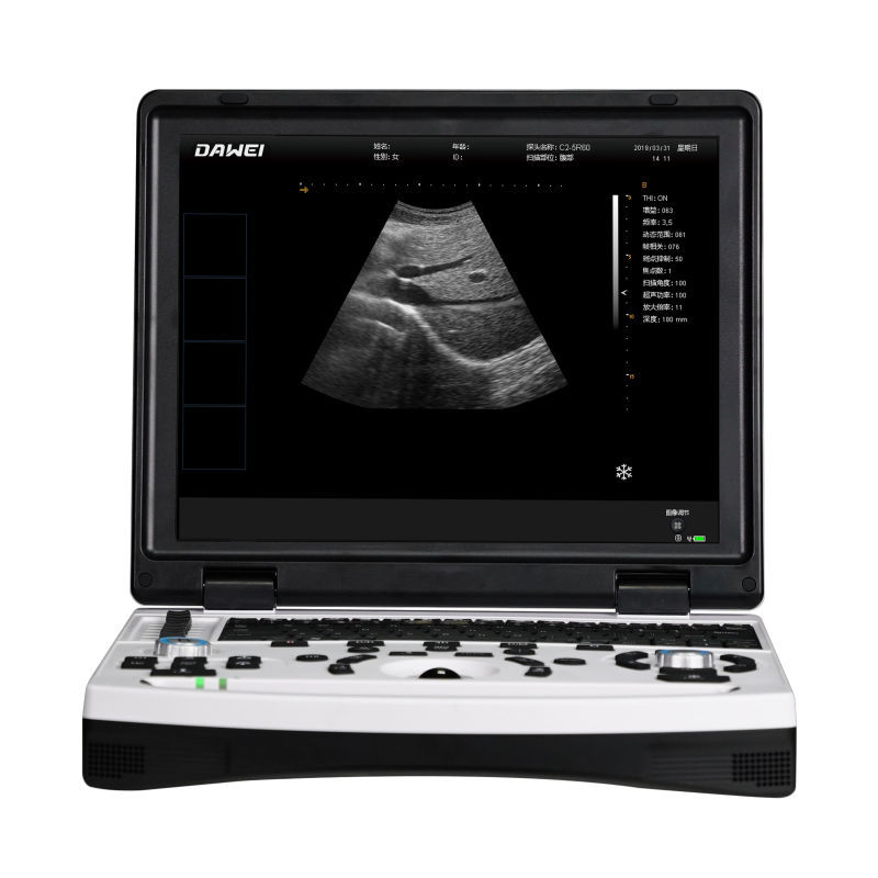 Portable ultrasound system - DW-690 - Dawei Medical - for urology ...