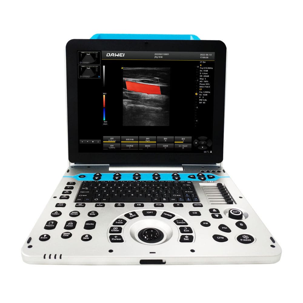 Portable veterinary ultrasound system - P3-VET - Dawei Medical - multipurpose / for small ...