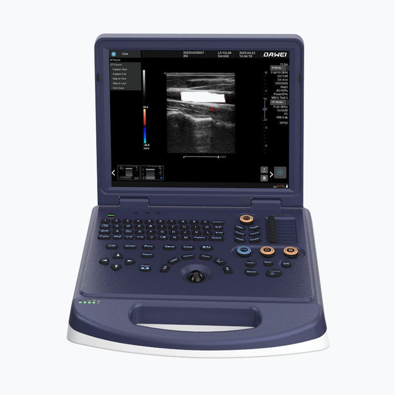 Portable veterinary ultrasound system - L30i-VÉT - Dawei Medical ...