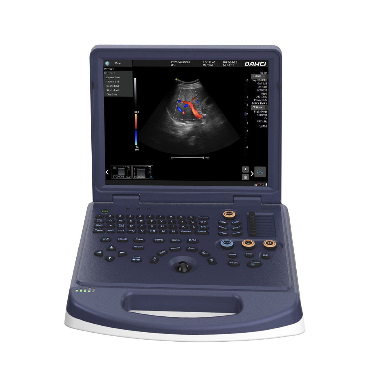 Portable ultrasound system - DW-L3i - Dawei Medical - for multipurpose ...
