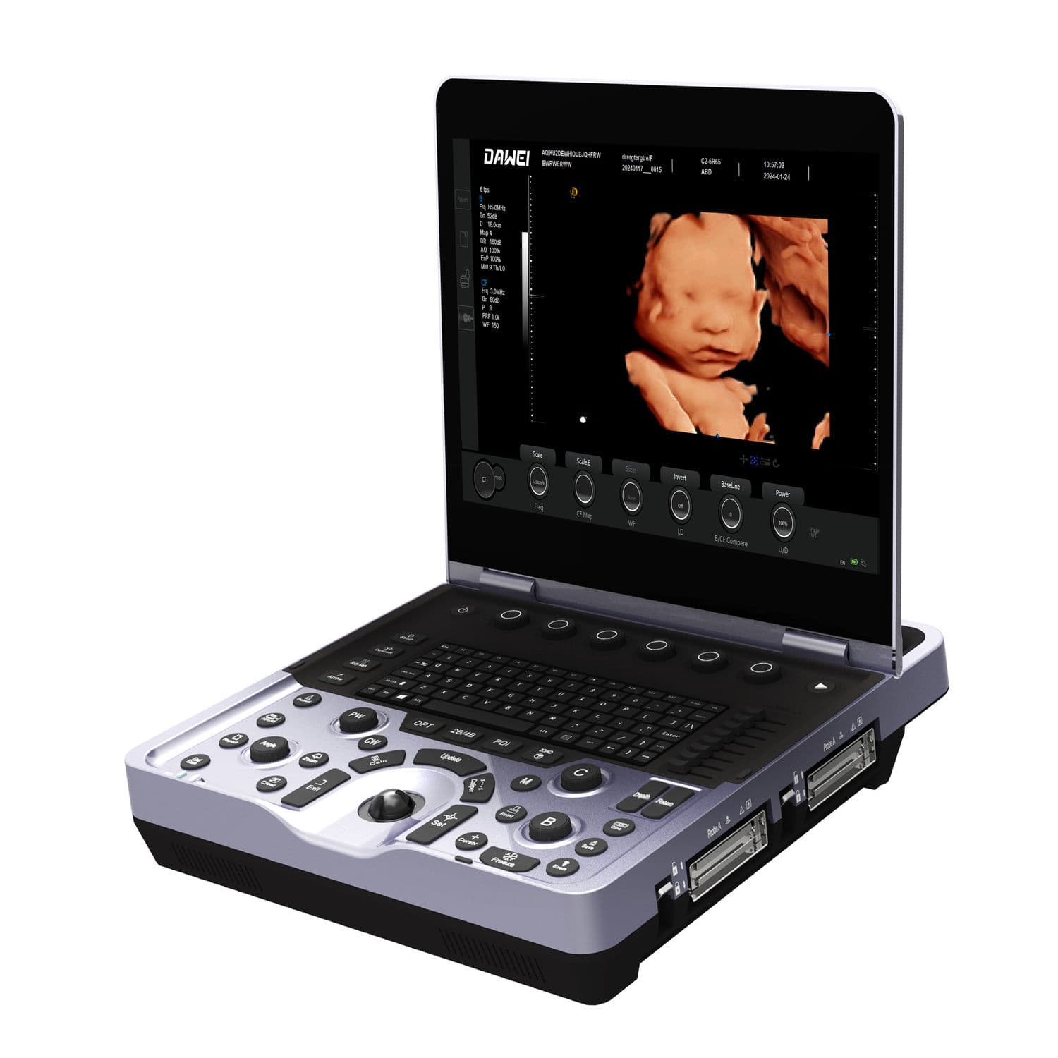 Portable ultrasound system - DW-L3S - Dawei Medical - for multipurpose ...