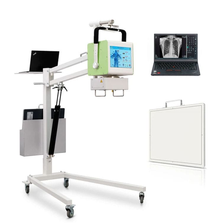 Digital mobile radiography unit - YSDR-050 - Fatali Medical