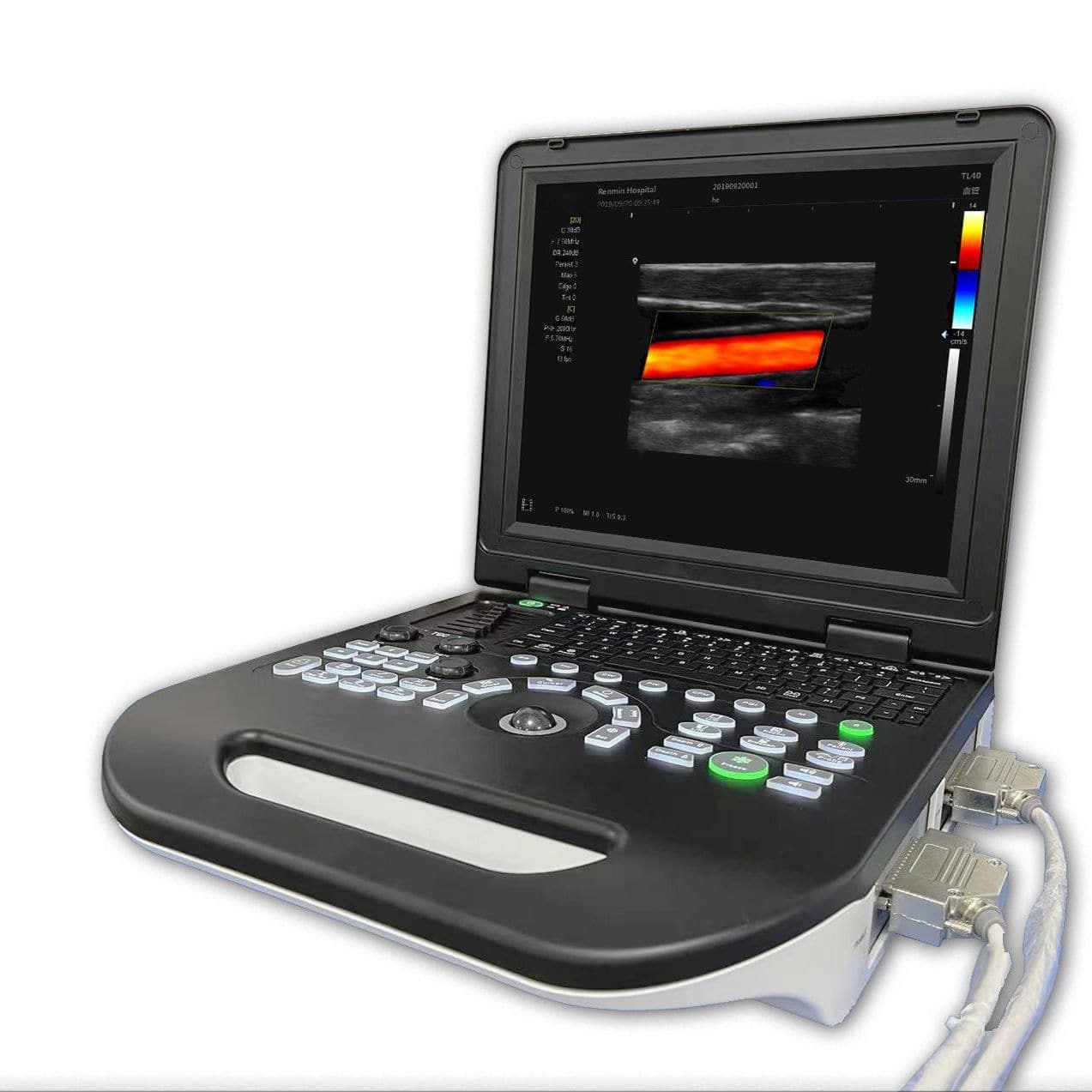 Portable ultrasound system - FTL-UTS100 - Fatali Medical - for ...