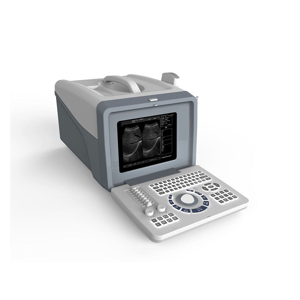 Portable ultrasound system - FTL-UTS70 - Fatali Medical - for ...